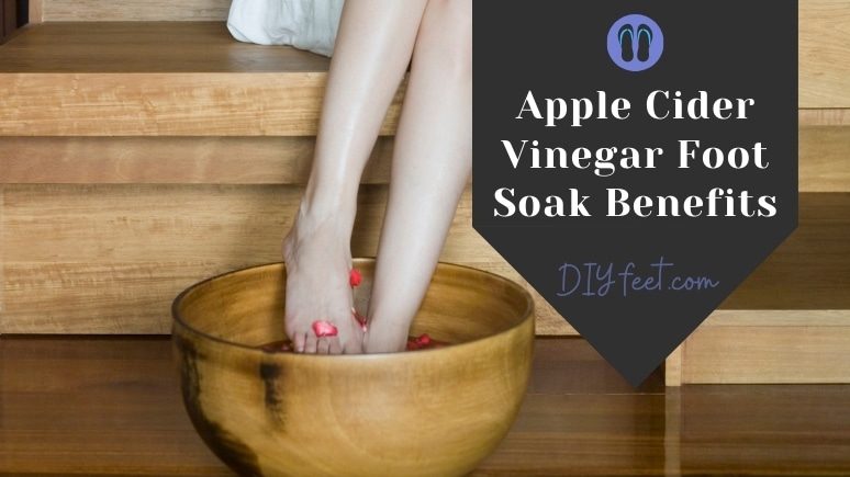 3 Terrific Apple Cider Vinegar Foot Soak Benefits Diy Feet